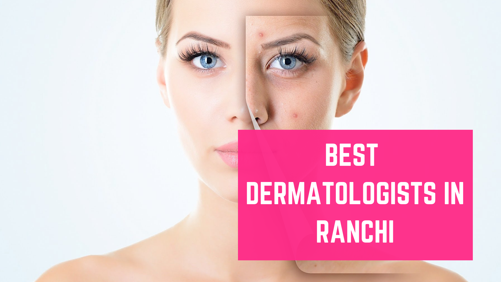 Top 10 Best Dermatologists in Ranchi- List 2020 - Essencz